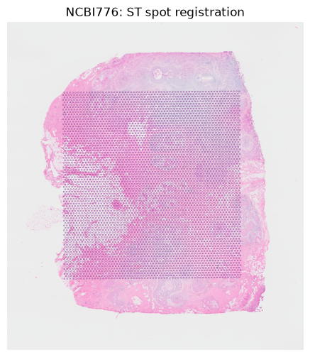 Spatial gene expression prediction from histology — LazySlide 0.12.0rc0 ...